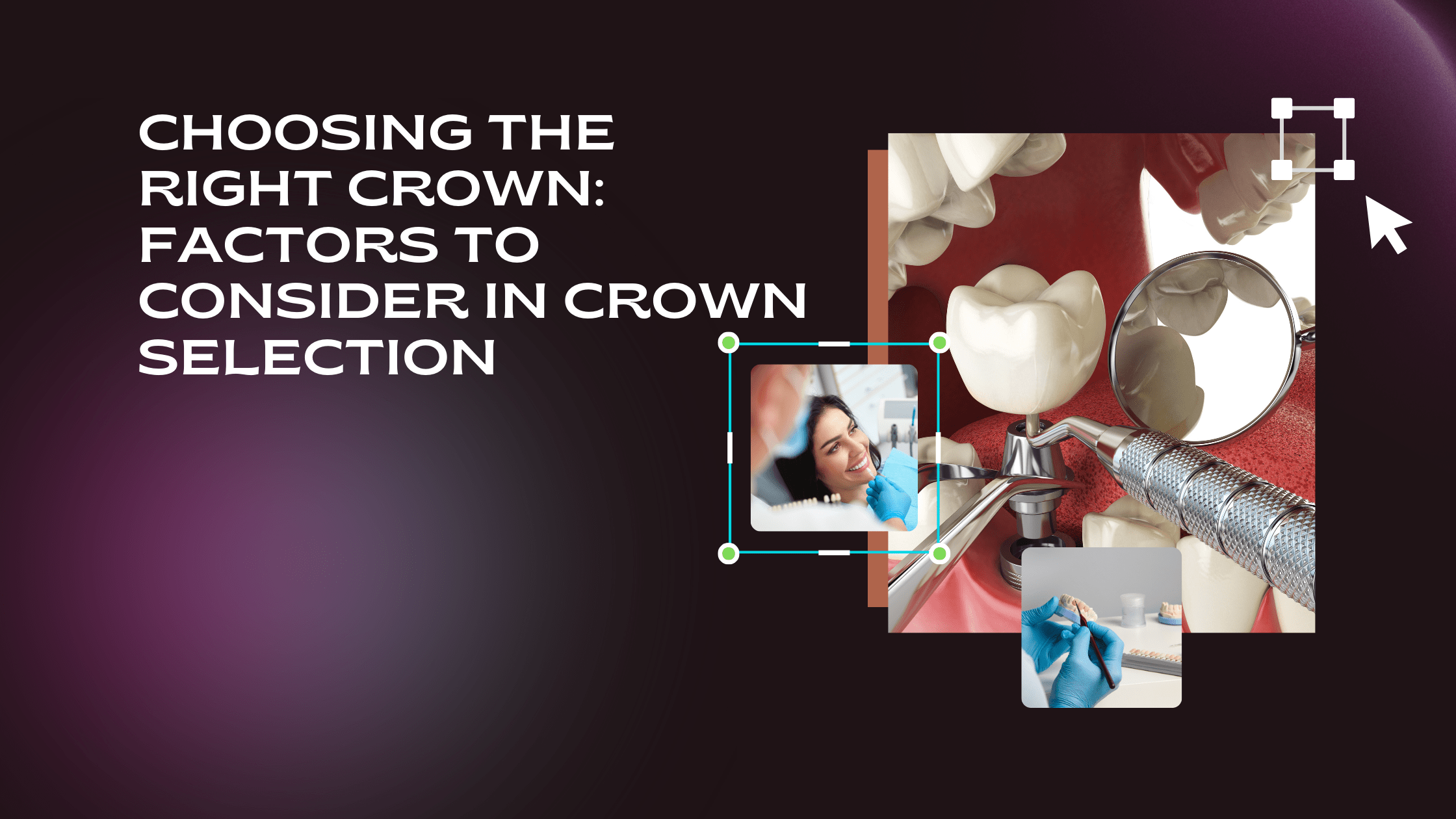 Choosing the Right Crown: Key Factors to Consider for Comfort