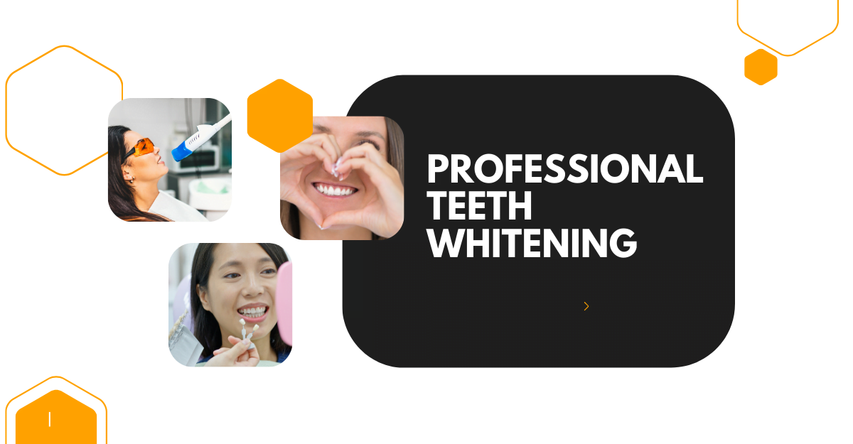 Ultimate Guide to Professional Teeth Whitening