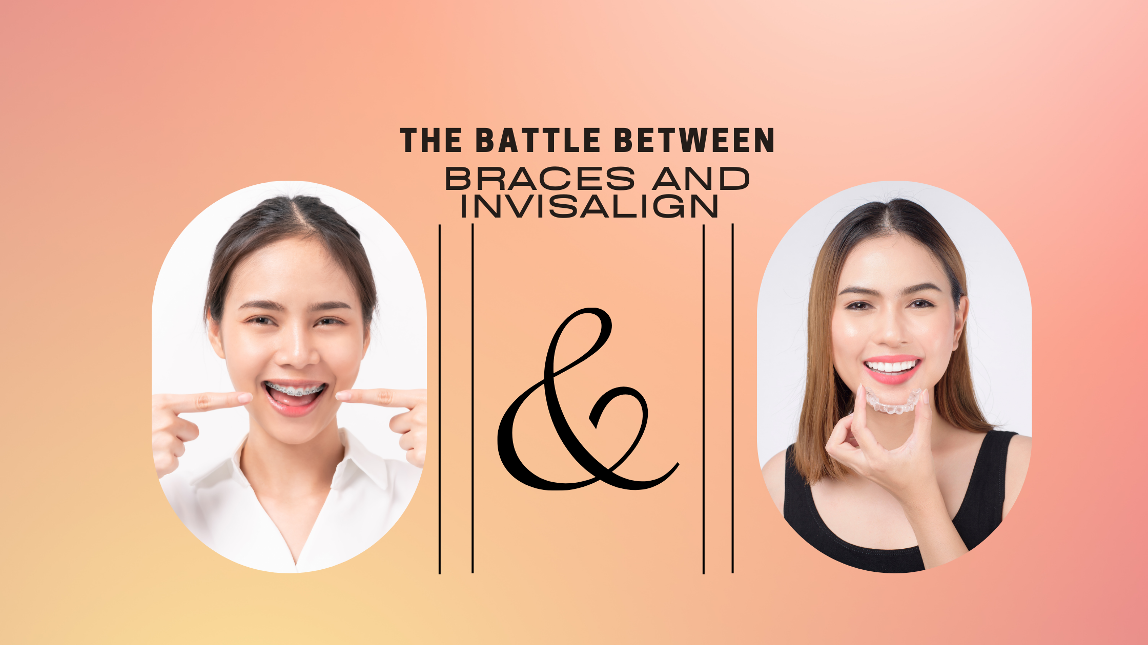 Braces vs. Invisalign: Navigating the Clear Choices